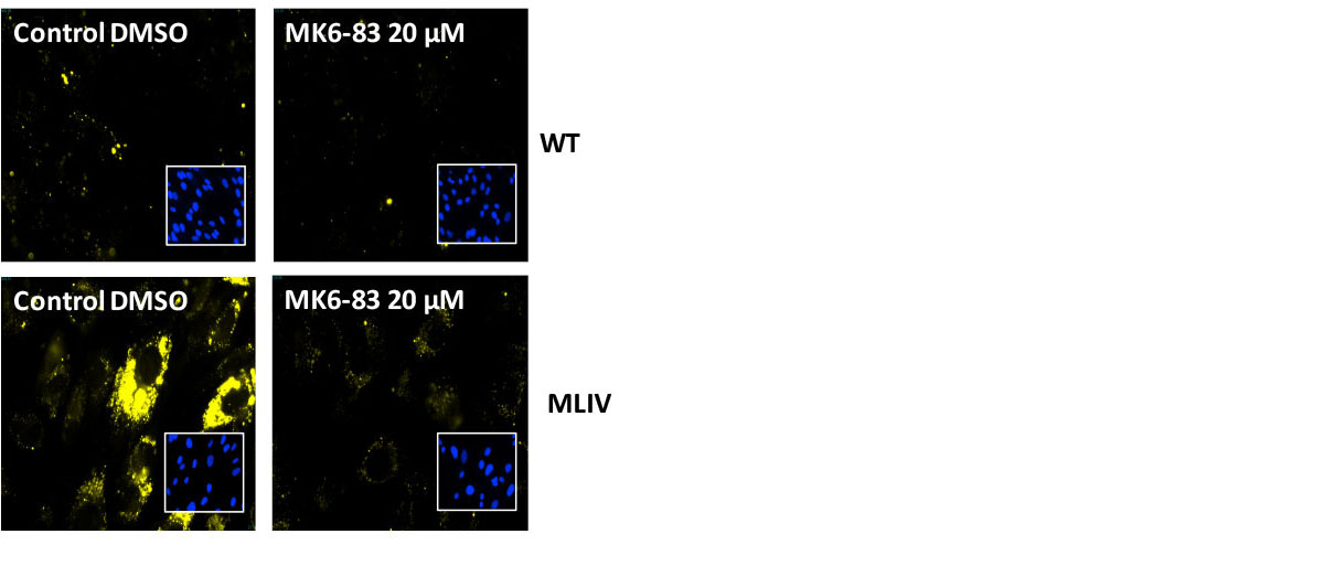Finding the right marker for our Mucolipidosis Type IV Screen